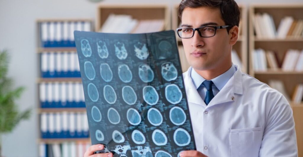 Best Neuro Doctor – Expert Brain & Nerve Care